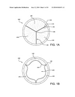 Innovations in Leaflet Design for Prosthetic Heart Valves